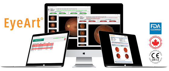 人工智能|EyeArt美国获批自动检测糖尿病视网膜病变(DR) | 百配健康-阅读越健康!