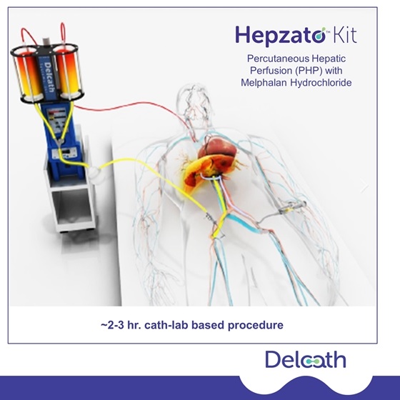 首款|HEPZATO(美法仑肝脏输送系统)美国获批治疗患有不可切除的肝脏为主的转移性葡萄膜黑色素瘤 | 百配健康-阅读越健康!
